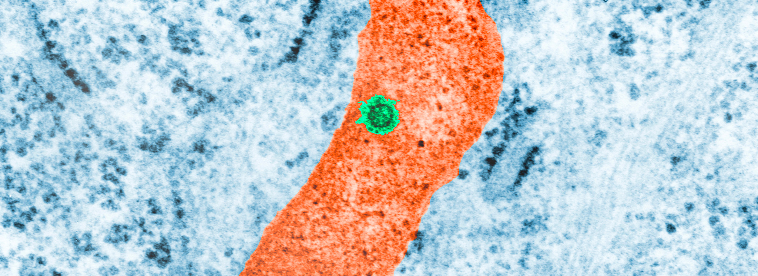 Dengue : informations et traitements - Institut Pasteur