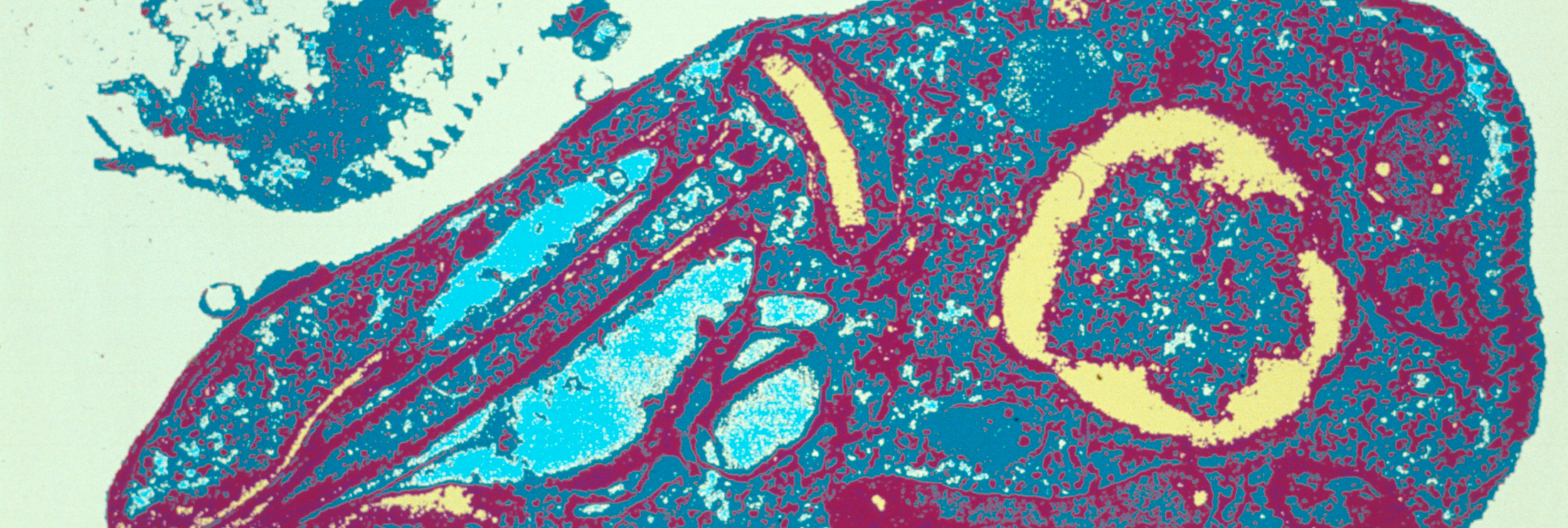 Leishmaniose : informations et traitements - Institut Pasteur
