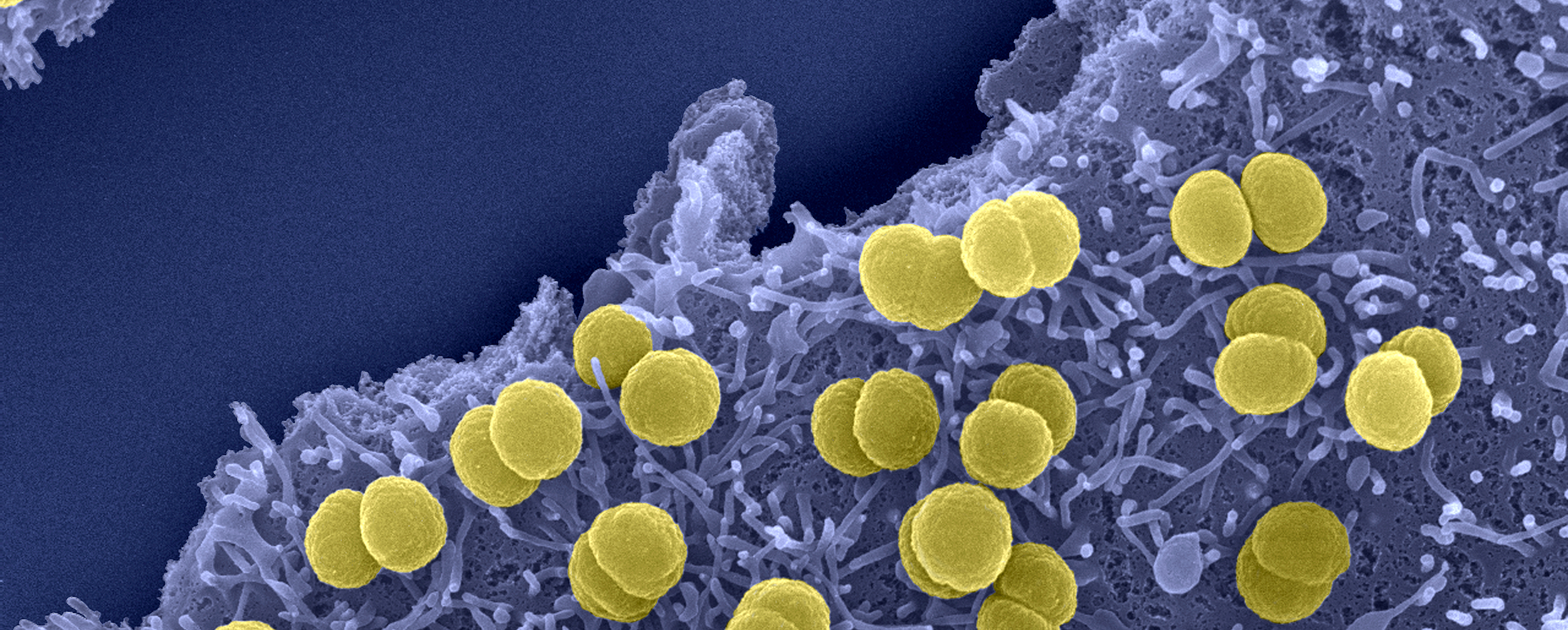 Méningites à méningocoques : informations et traitements - Institut Pasteur