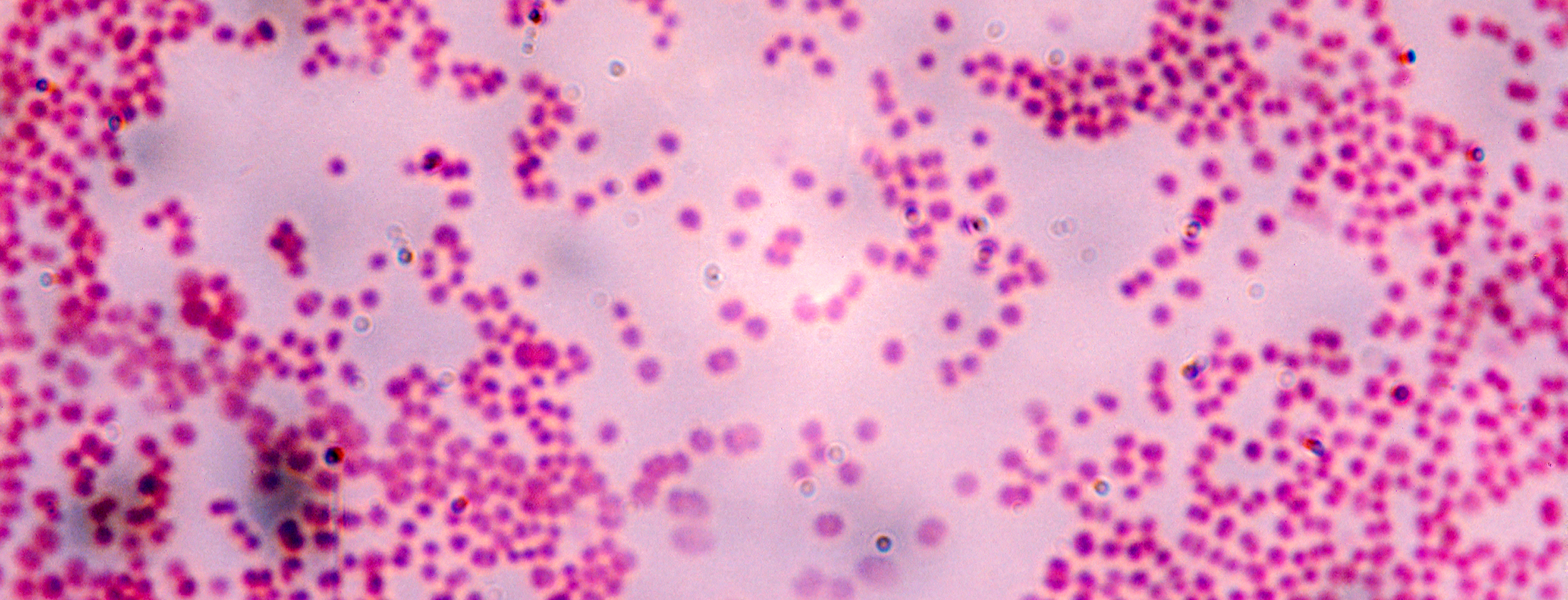 Sepsis / septicémie : informations et traitements - Institut Pasteur