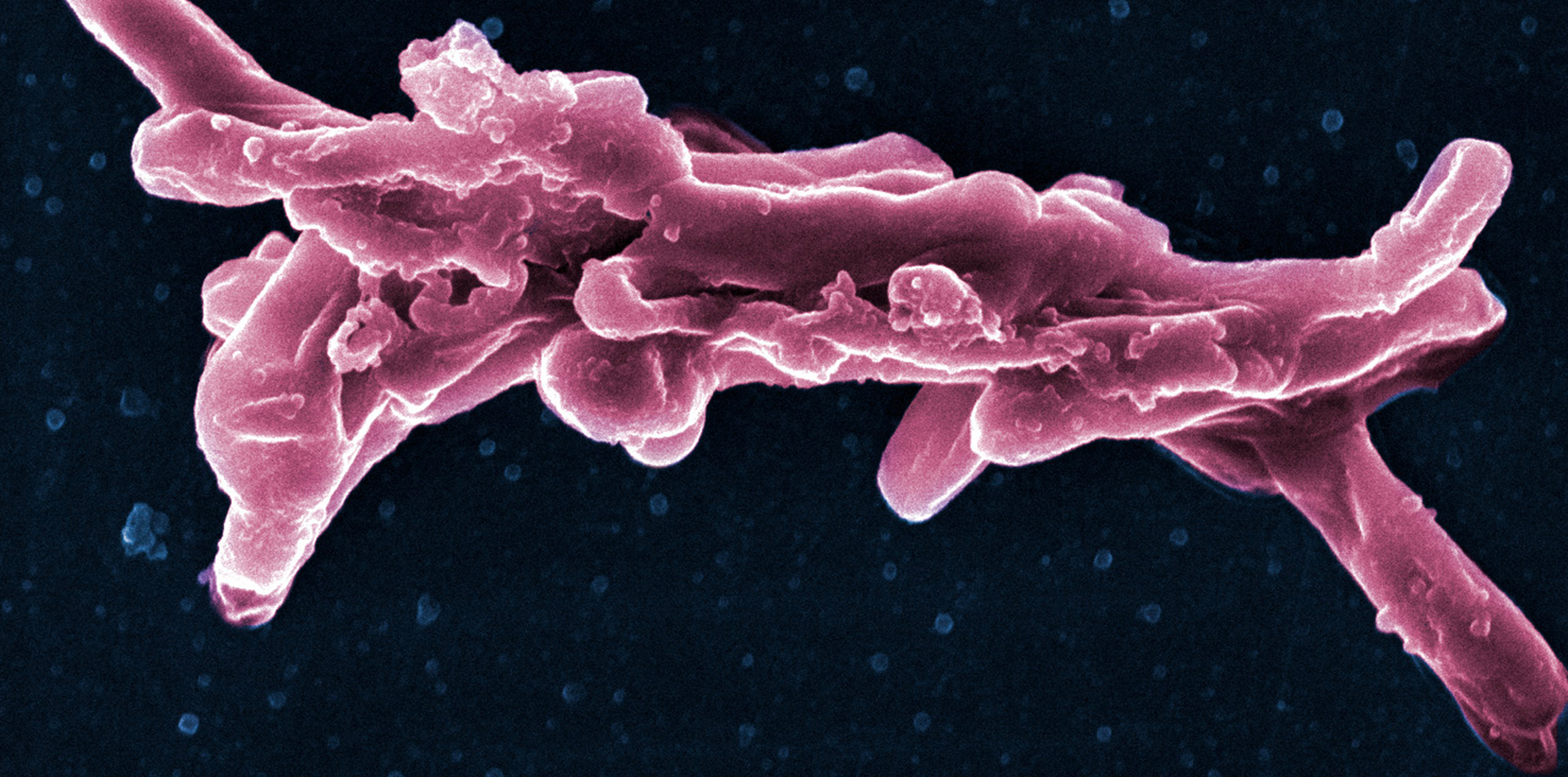 Tuberculose : informations et traitements - Institut Pasteur