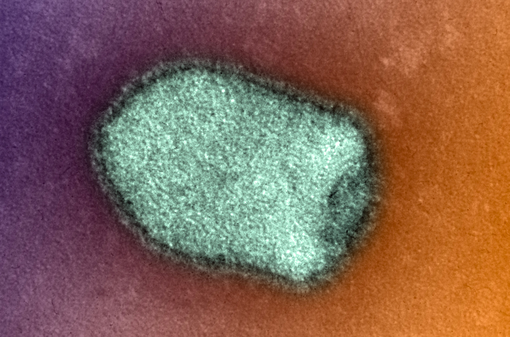 Explications et conseils suite au cas de rage survenu en France - L ...