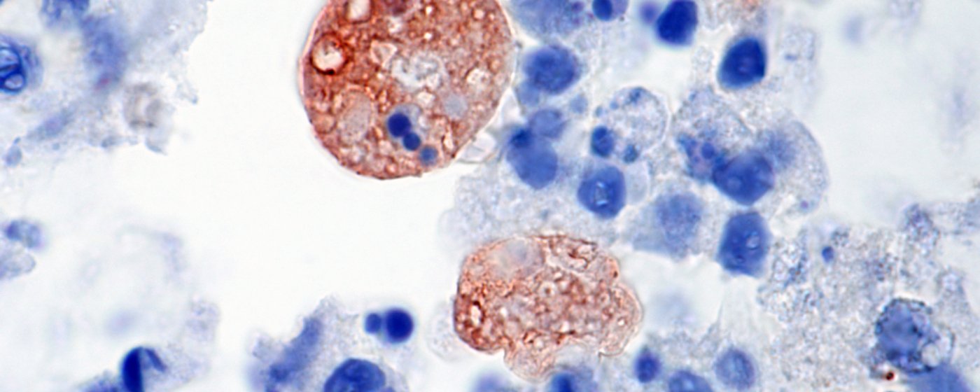 Amoebiasis | Institut Pasteur