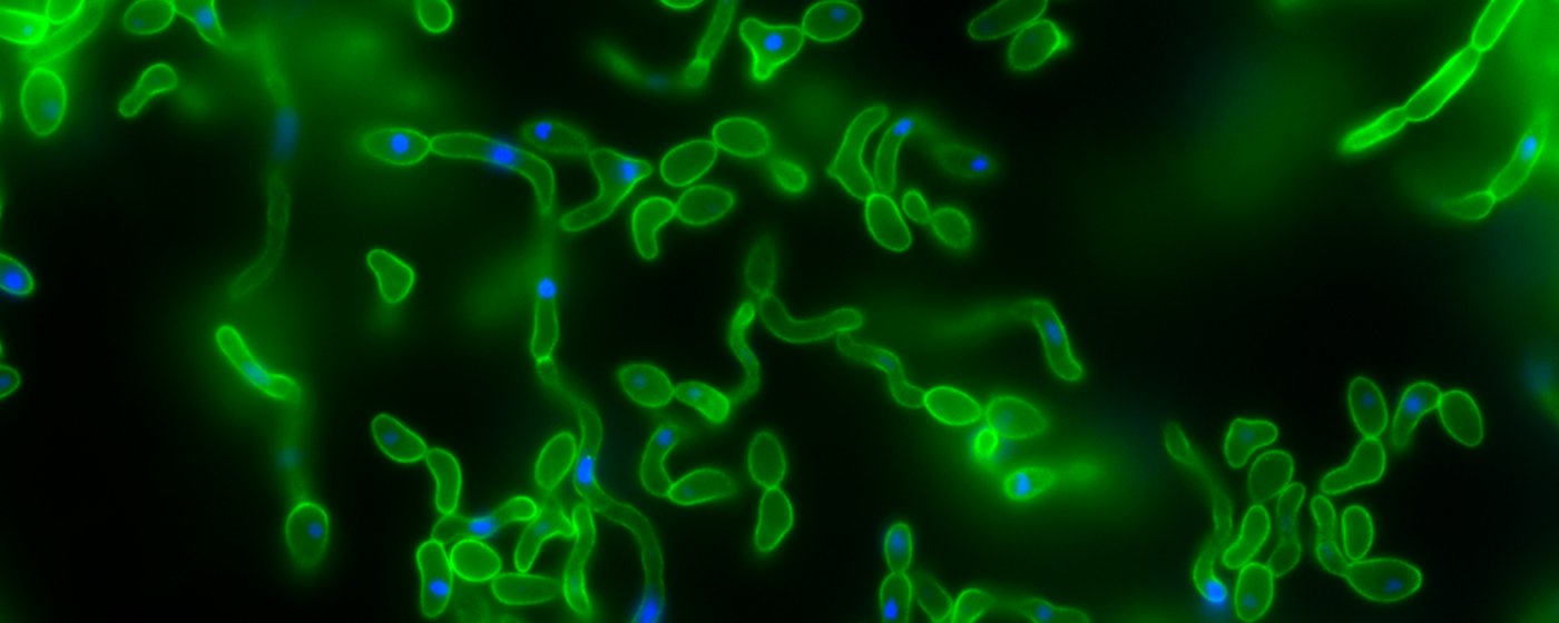 Candidoses : informations et traitements - Institut Pasteur