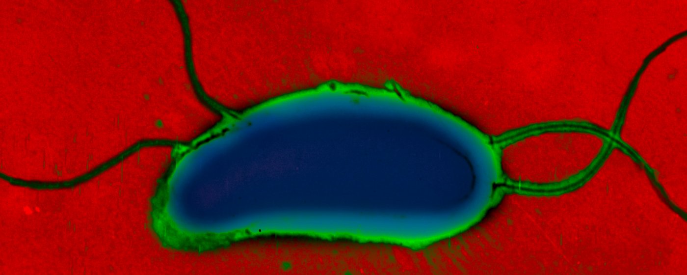 Choléra : : informations et traitements - Institut Pasteur