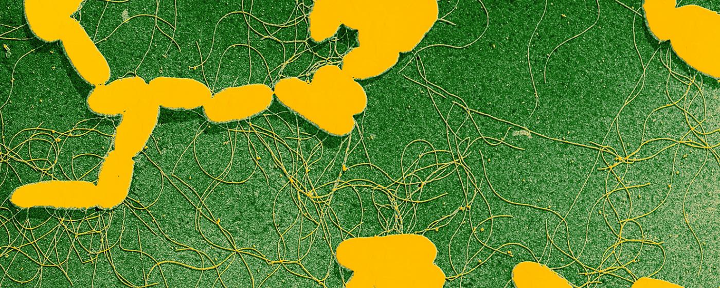 Fièvres typhoïde et paratyphoïde : informations et traitements ...