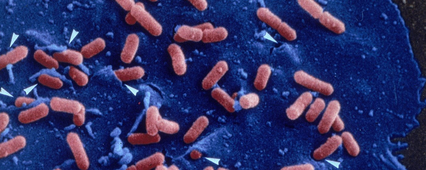 Listériose : informations et traitements - Institut Pasteur