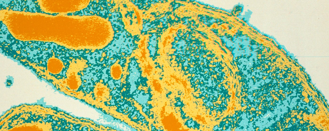 Paludisme : informations et traitements - Institut Pasteur