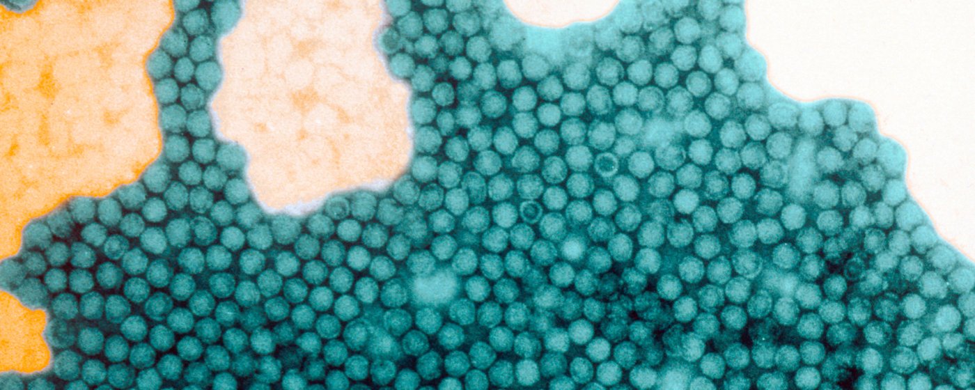 Poliomyélite : informations et traitements - Institut Pasteur