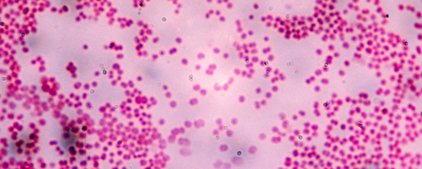 Sepsis / septicémie : informations et traitements - Institut Pasteur