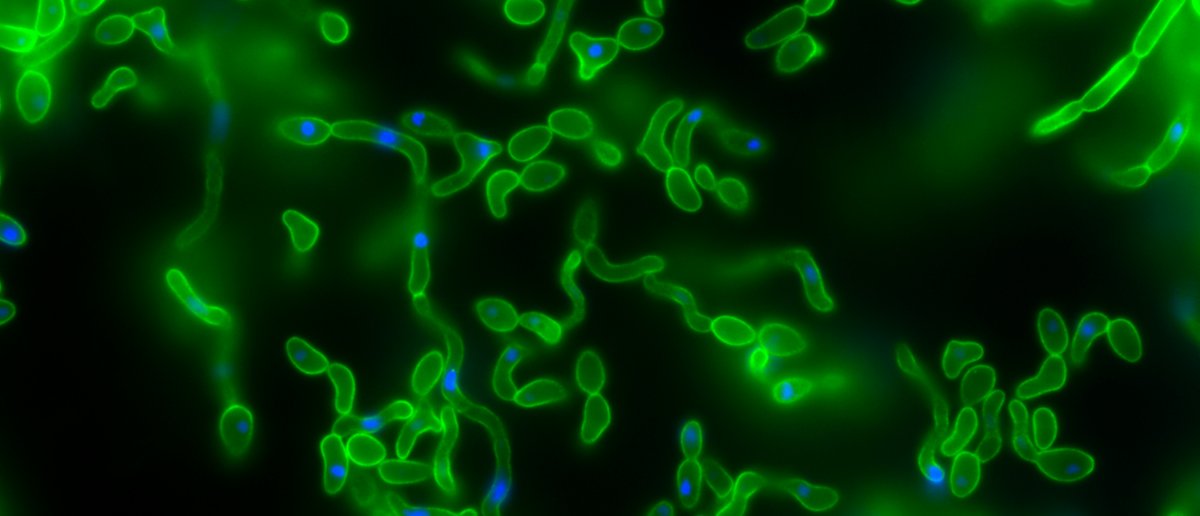 Candidiasis : symptoms, treatment, prevention - Institut Pasteur