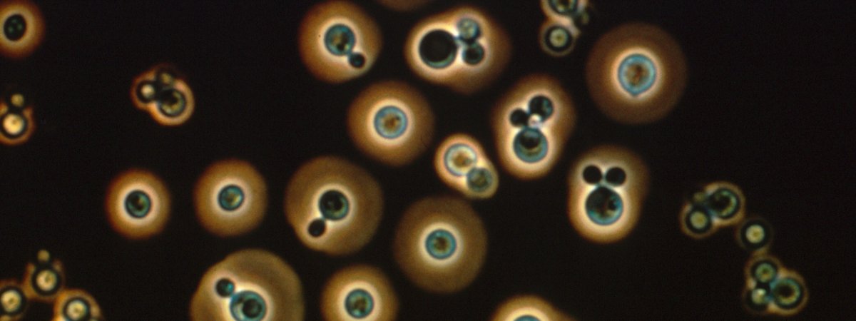 Cryptococcosis : symptoms, treatment, prevention - Institut Pasteur