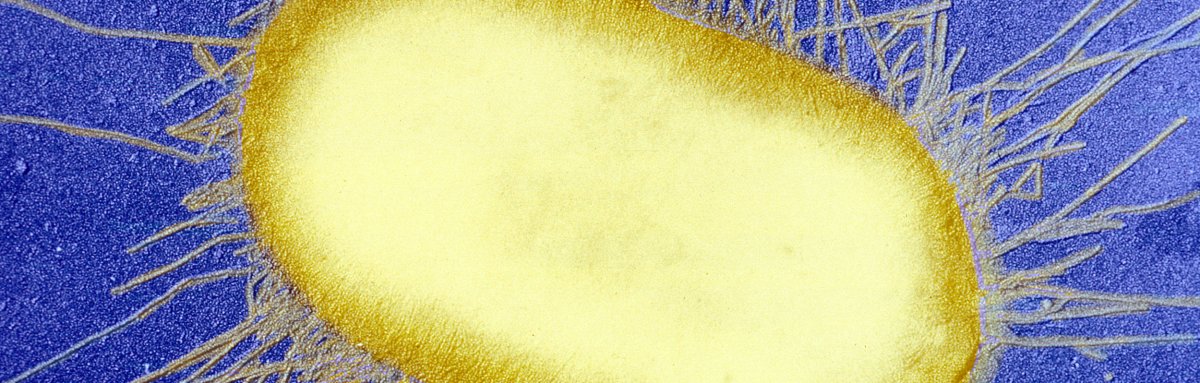 Escherichia coli : symptoms, treatment, prevention - Institut Pasteur