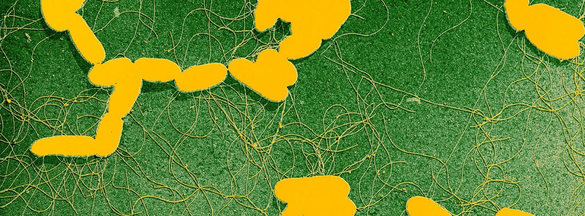 Typhoid and paratyphoid fever: symptoms, treatment, prevention ...