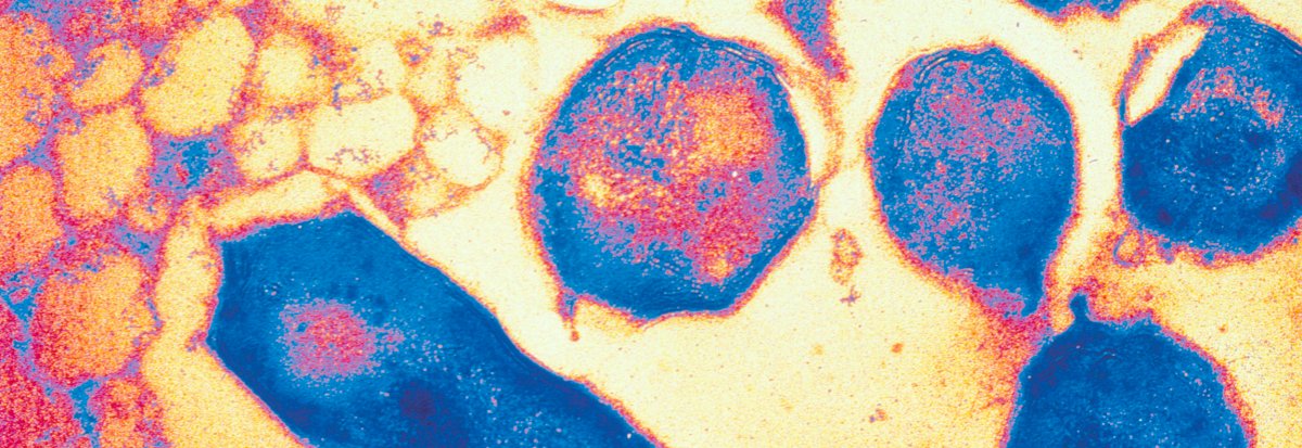 Lèpre : symptômes, traitement, prévention - Institut Pasteur