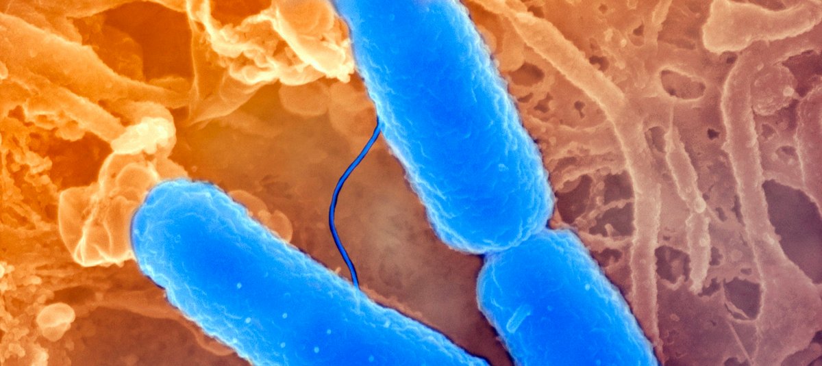 shigella bacteraemia