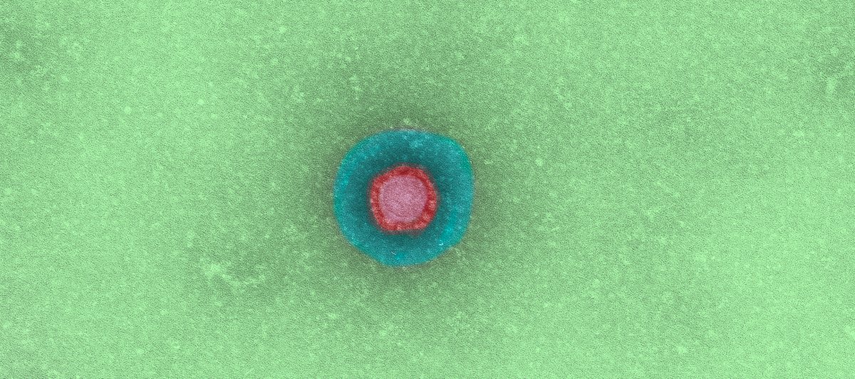 SRAS : symptômes, traitement, prévention - Institut Pasteur