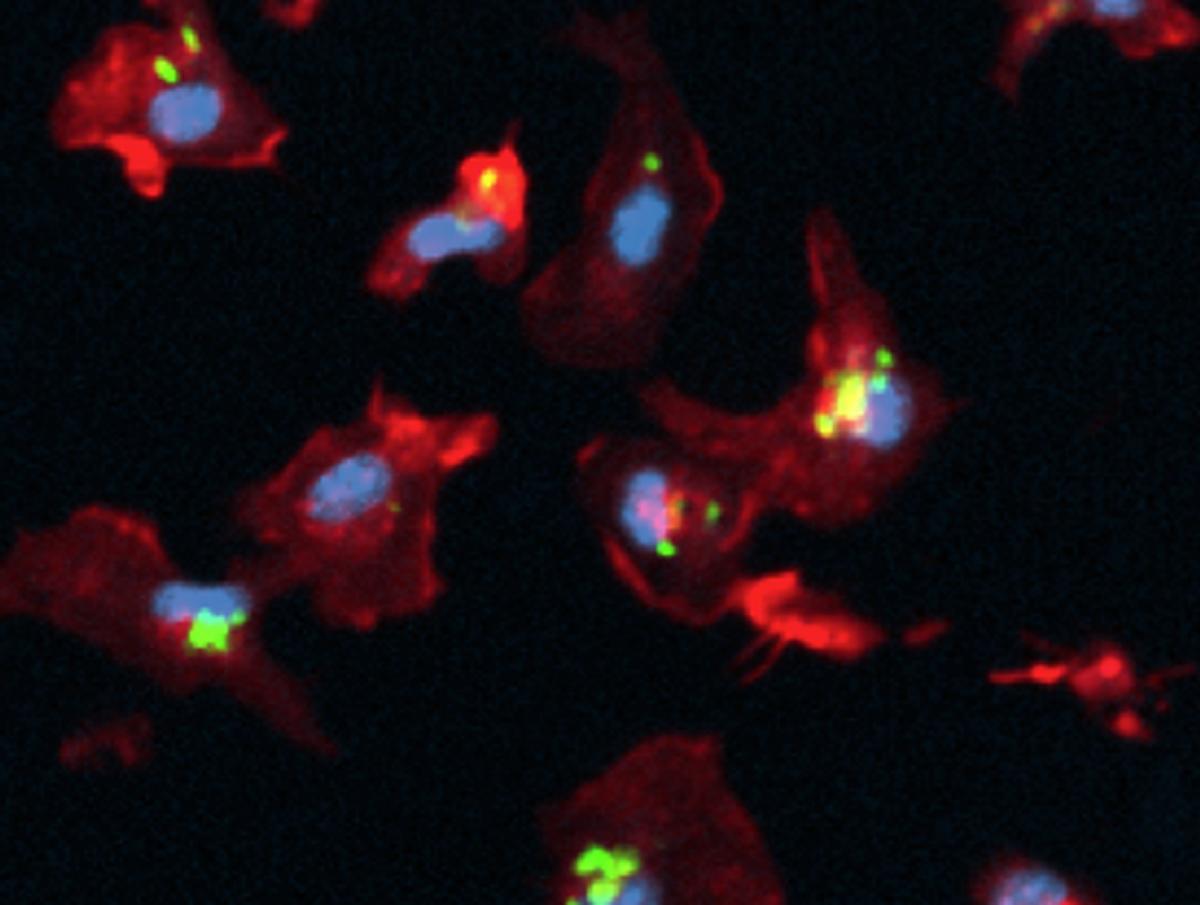 A new approach for improving BCG