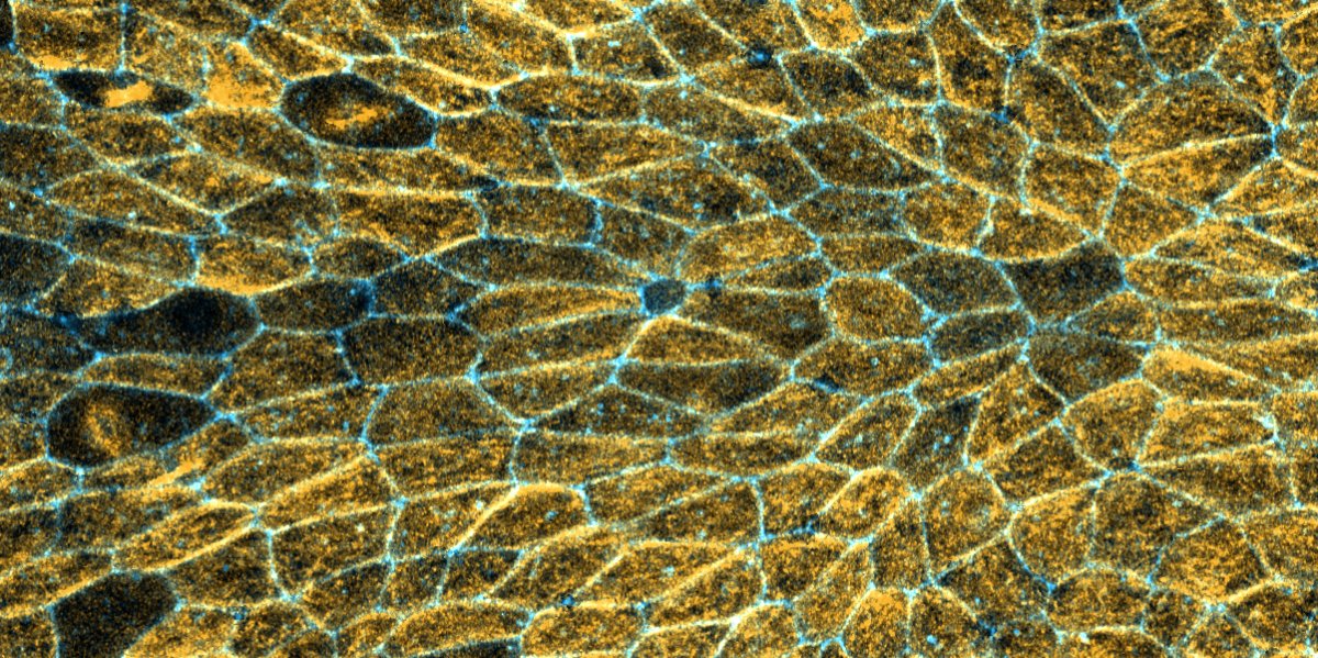 How ‘death’ molecules squeeze the cells out of our tissues | Institut ...