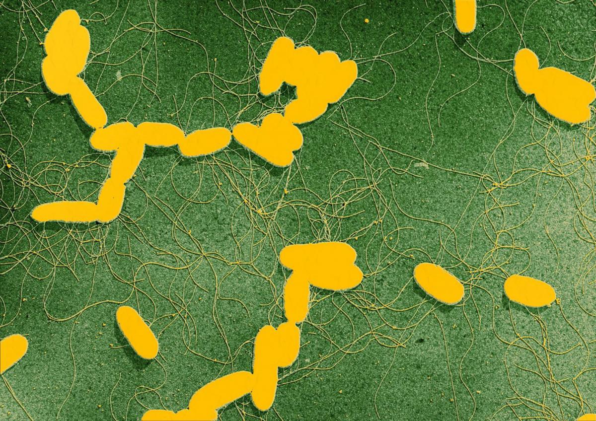 Salmonellose : l’Institut Pasteur a lancé l’alerte ! - L'actu de l ...