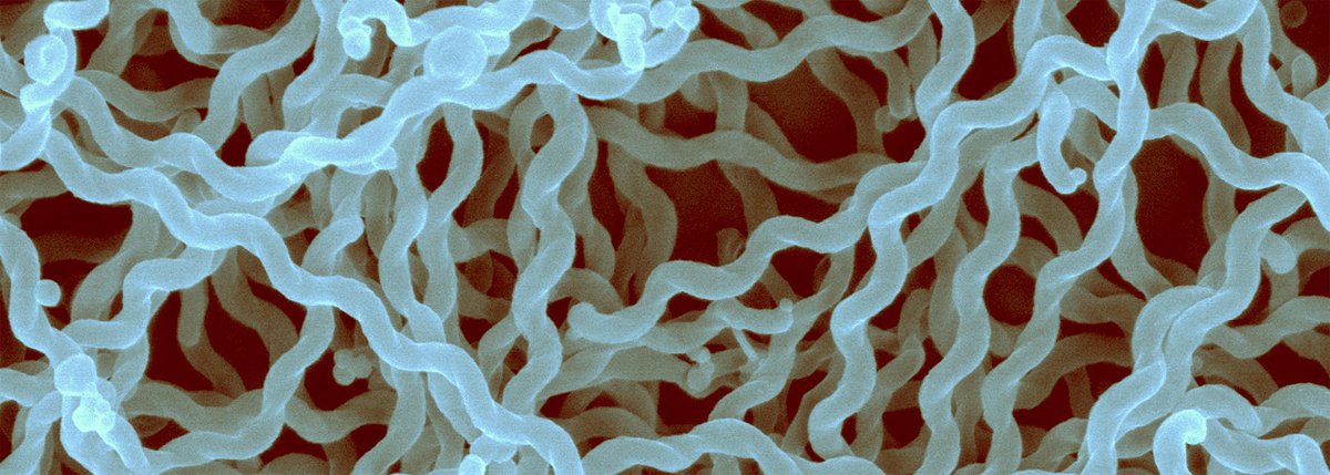 Leptospirosis: understanding why some fresh water bacteria are virulent ...