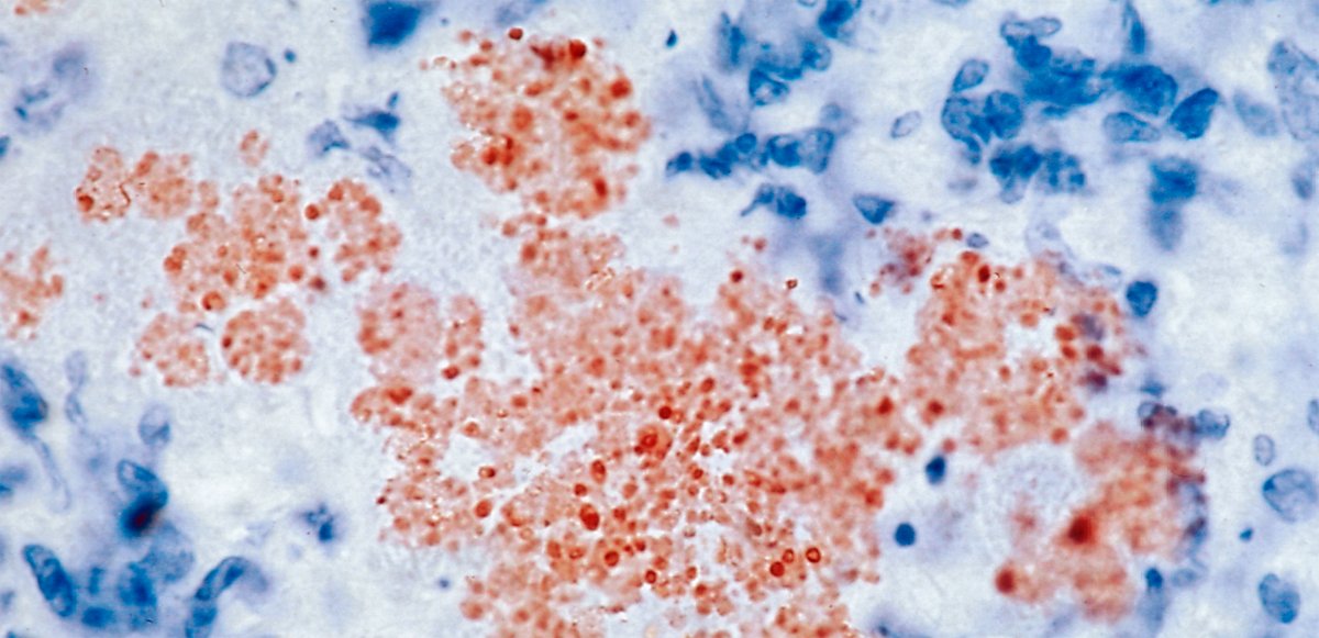 Les infections à Yersinia - Institut Pasteur