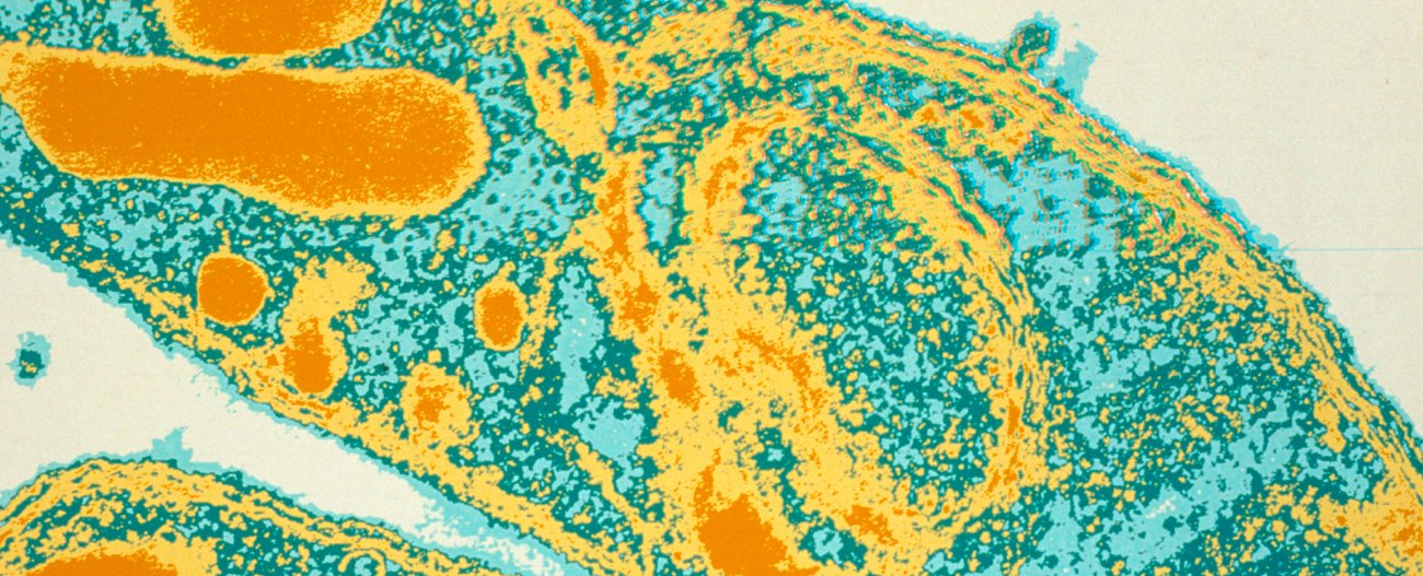 Paludisme : informations et traitements - Institut Pasteur