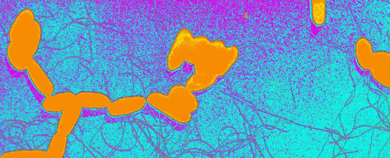 Salmonellose : informations et traitements - Institut Pasteur